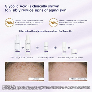 Glytone Rejuvenating Cream with 20 Free Acid Value Glycolic Acid, Moisturizer, Rich Creamy Emollient, Exfoliate, Normal to Dry Skin, 1.7 Fl Oz