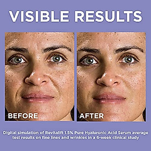 L'Oreal Paris Revitalift 1.5% Pure Hyaluronic Acid Face Serum, to Hydrate, Visibly Plump Skin, & Reduce Wrinkles, Fragrance Free 1 oz