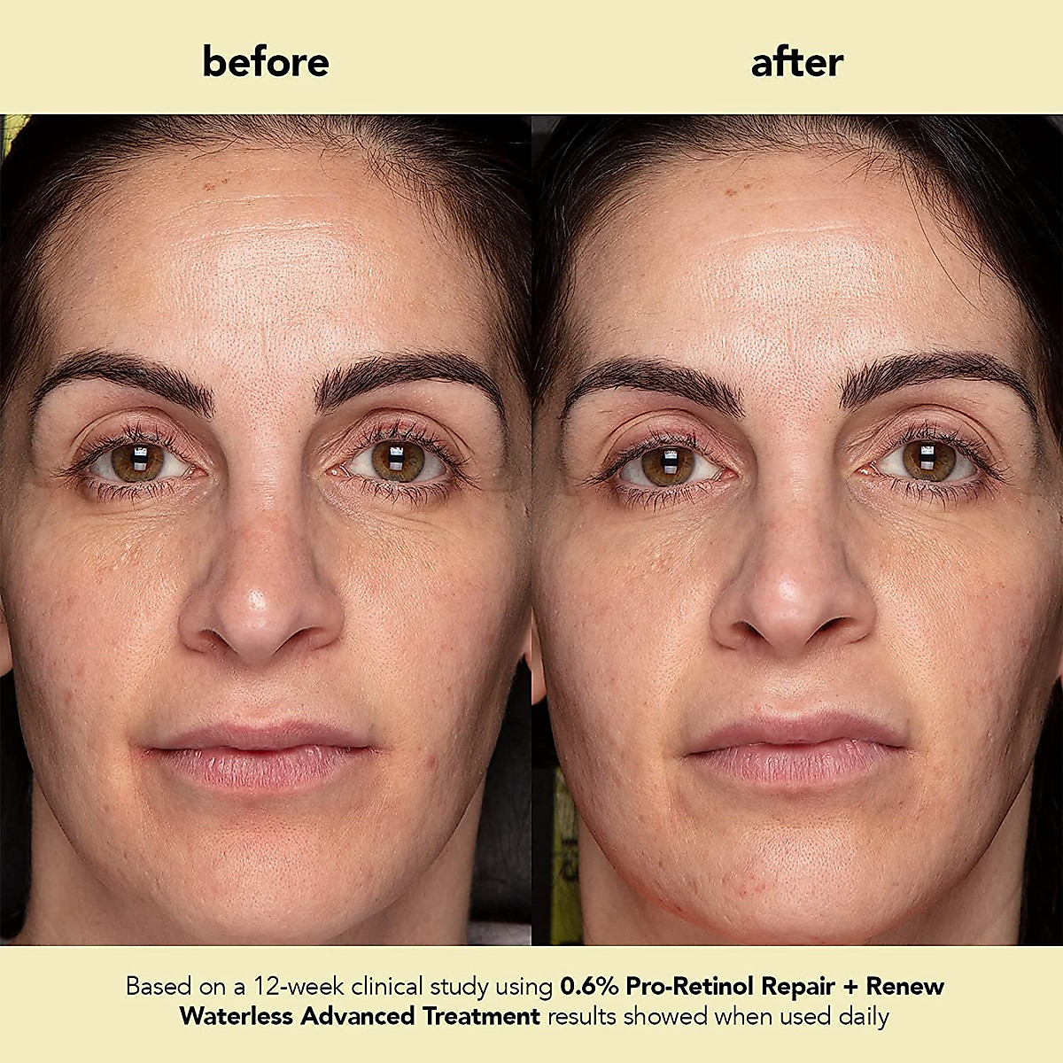 boscia 0.6% Pro-Retinol Repair + Renew Waterless Advanced Treatment - Vegan, Cruelty-Free, Natural Skin Care - For Fine Lines & Wrinkles - 1 fl oz