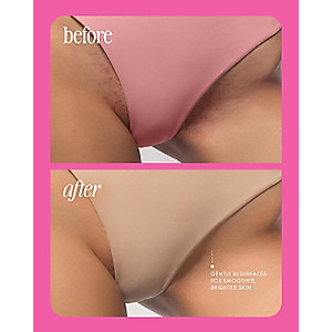 Truly Beauty Pre-Shave Exfoliator for Bikini Area - Ingrown Hair Treatment and Body Scrub - Bikini Exfoliating Scrub - 4 OZ