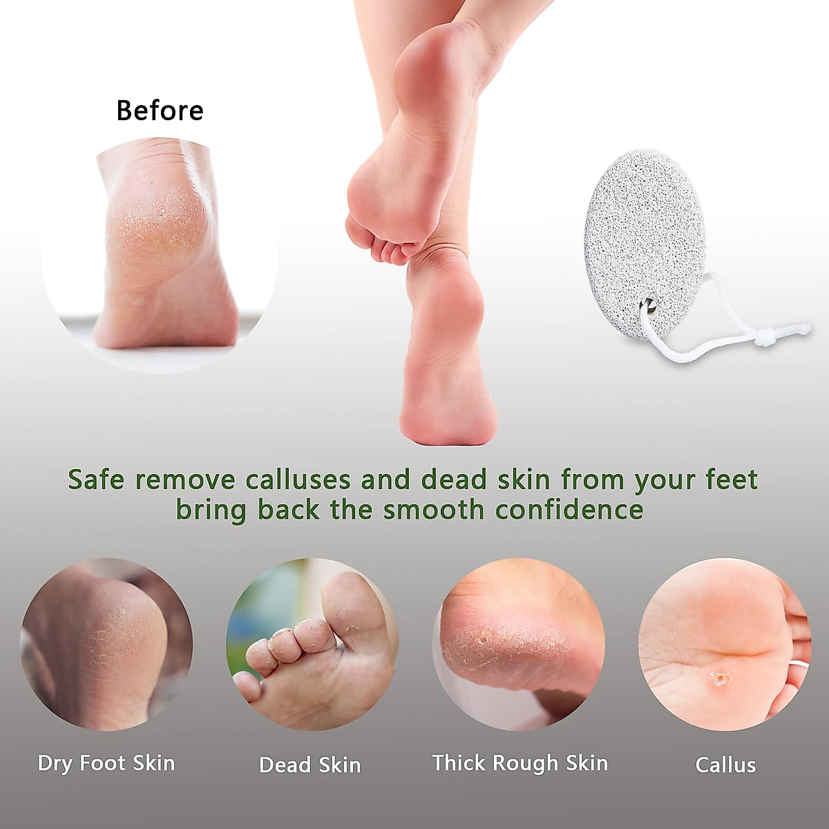 Natural Foot Pumice Stone for Feet, Borogo 2-Pack Lava Pedicure Tools Hard Skin Callus Remover for Feet and Hands - White&Red