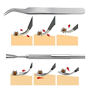 Yogini Stainless Steel Tick Removal Kit,Tick Tweezers, Tick Fork and Portable Storage Case,Tick Removal Tool for Humans and Pets (1 Set)