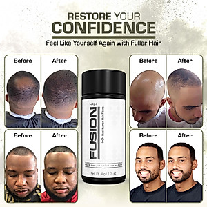 Hair Fibers for Thinning Hair - (1.05 Oz) Real Human Hair Building Fibers to Conceal Bald Spots and Thinning Hair, Root Touch Up and Volumizer, Black