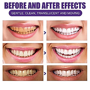 Tooth Care Tooth Powder Removing Tooth Stains and Tooth Washing Powder Fresh Breath Teeth Removing Bad Breath Teeth ning Sensitive