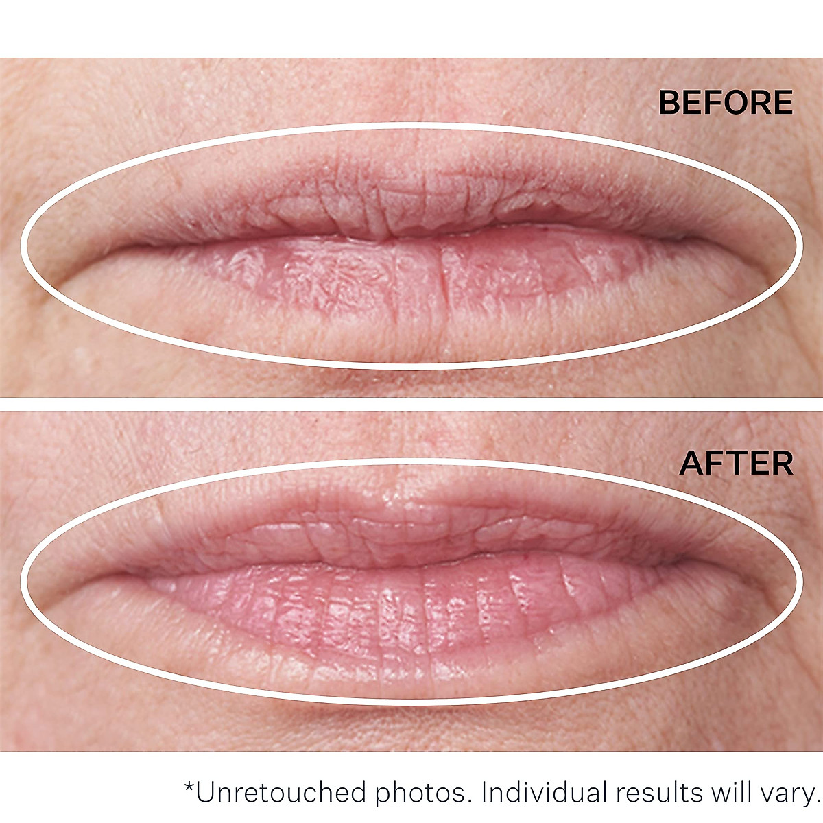 StriVectin Anti-Wrinkle Double Fix for Lips Plump and Smooth Vertical Lines, Hydrating Two-in-One Treatment, 0.16 Fl O