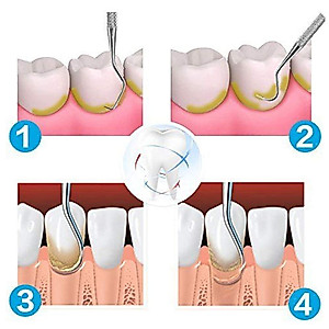 Dental Cleaning Tools Set For At Home Use - Oral Care Dental Hygiene Kit Includes Teeth Scraper For Plaque, Mirror, Scaler, Pick - These Teeth Cleaning Tools Are Made From Stainless Steel