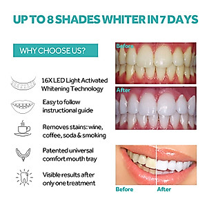 Teeth Whitening Light, PHOEBE New Upgrade 16 LED Teeth Whitening Accelerator Light Mouth Tray Teeth Whitening Enhancer Light Trays Connected with iPhone/Android/Type-C for Home Use