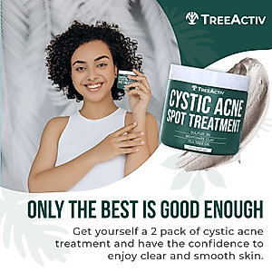 TreeActiv Cystic Acne Spot Treatment, 2-Pack, Sulfur Spot Treatment, Hormonal Acne Treatment with Tea Tree, Cystic Acne, Blackheads, Cystic Acne Treatment and Pimple Spot Treatment for Face, 240+ Uses