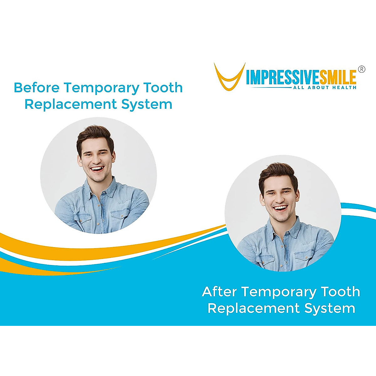 Impressive Smile Patient Trusted Temporary Tooth Replacement System