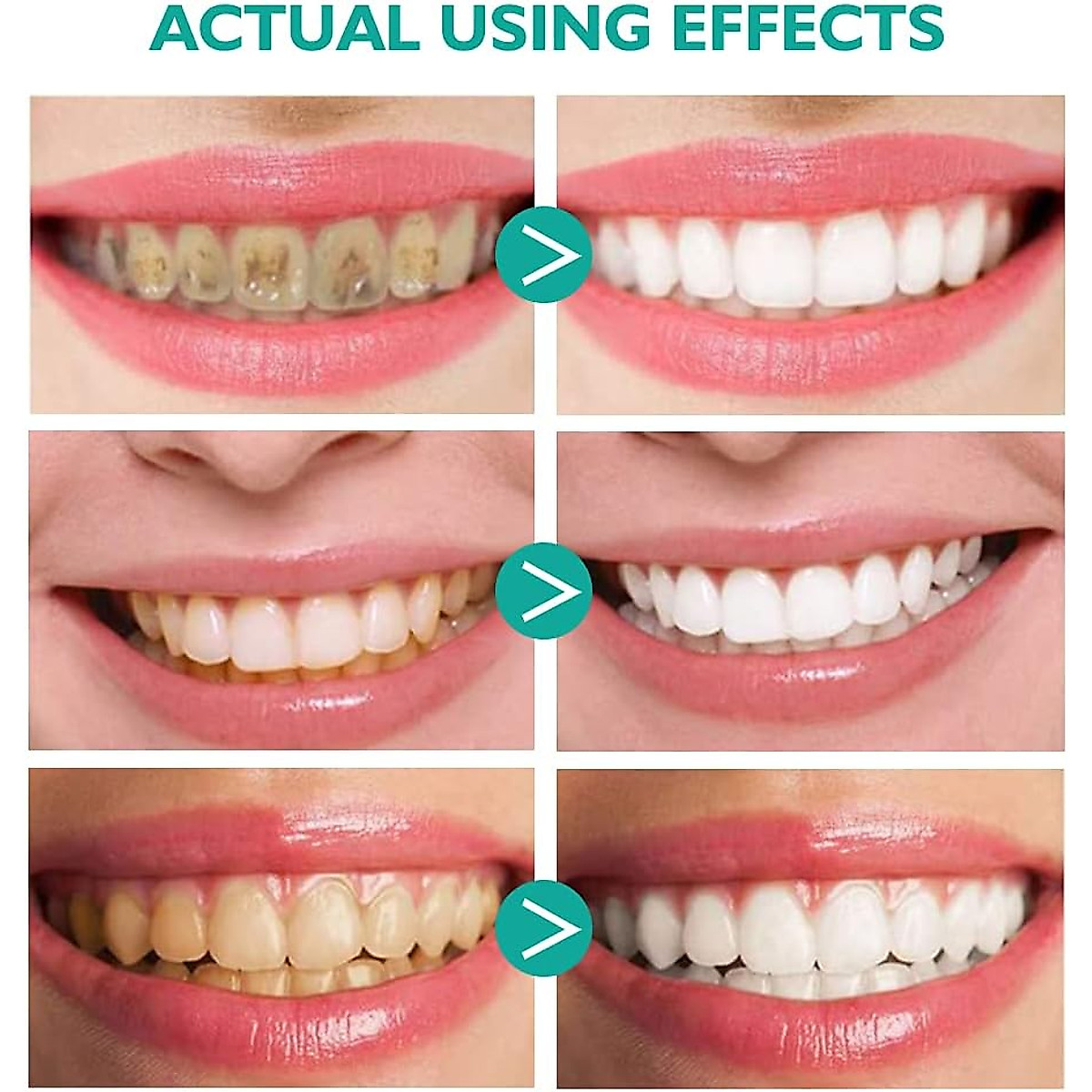 2 Pcs Foam Toothpaste, Ultra-fine Mousse Foam Deeply Cleaning Gums, Whitens Teeth & Deeply Gums Care & Easy to Use, 360ºCare for Oral Health, 60ml*2 (Mint, 2pcs)