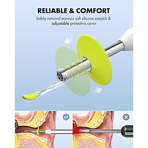 Anykit 3.9 mm Visual Digital Otoscope with 6 LED Lights and Earwax Removal Tool for Adults & Children, Compatible with iPhone & Android