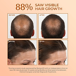 BosleyMD Hair Growth Set for Men and Women, Includes Follicle Energizer, DHT Blocker, for Hair Regrowth + BosRevive Volumizing Shampoo for Color Treated Hair, 10.1 Fl Oz