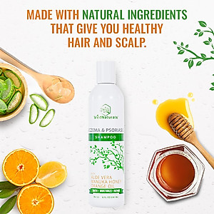 Psoriasis Shampoo for Dry Scalp Care - Anti Dandruff - Gentle Hydrating Shampoo for Itchy Scalp Treatment