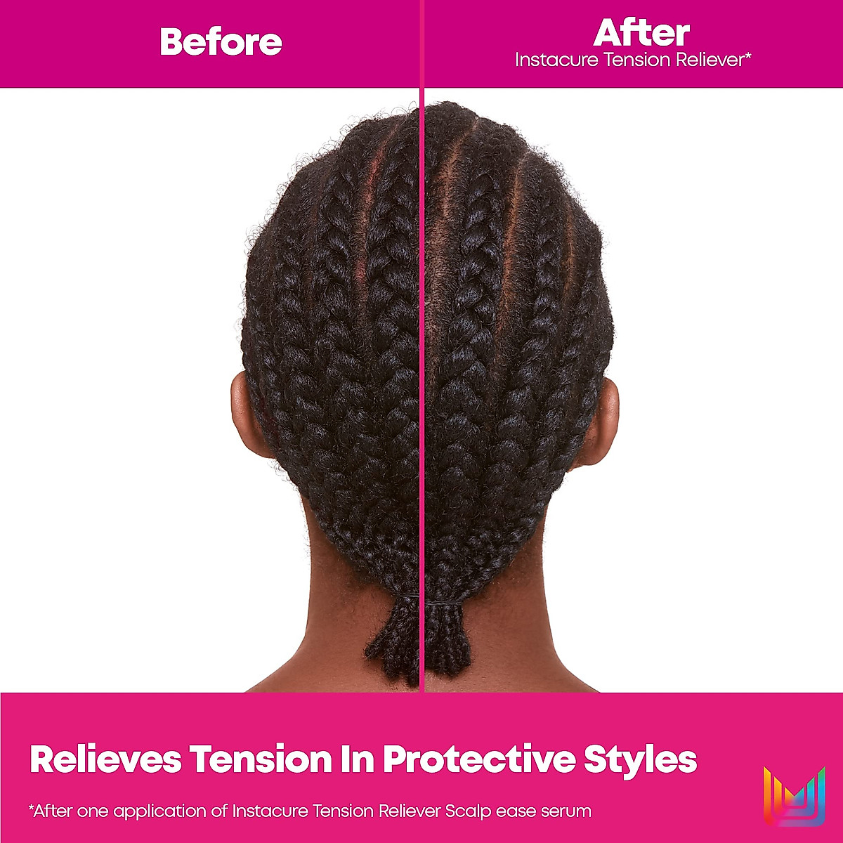 Matrix Instacure Tension Reliever Leave-In Scalp Serum | Moisturizes Dry, Irritated Scalp | Cools Tension in Braids, Protective & Tight Hairstyles | Scalp Pain Relief | 6.8 Fl. Oz. | Vegan