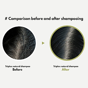 LA'DOR TripleX 3 Deep Cleansing Shampoo for Dry Itchy Sensitive Scalp Dandruff w/Tea Tree Lemon Lavender Sulfate-free Korean Hair Care 10 Fl Oz