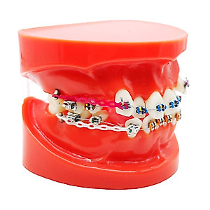 Dental Typodont With Metal Brackets Orthodontic Teeth Model With Ligature Ties Red