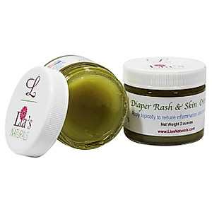 Lia's Naturals Skin Ointment & Diaper Rash Cream 100% Organic Clinically Tested