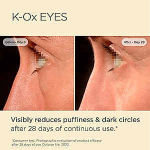 ISDIN K-Ox Under-Eye Brightening Cream for Puffiness and Dark Circles with Anti-Aging Benefits, Vitamin K and Hyaluronic Acid, visible results in 28 days of usage