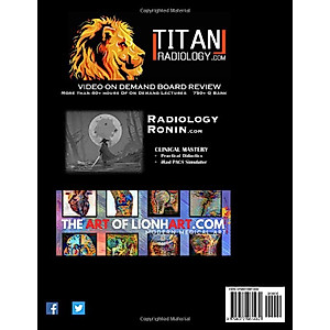 Crack the Core Exam volume 2 (Crack the Core Exam - Radiology Board Review)