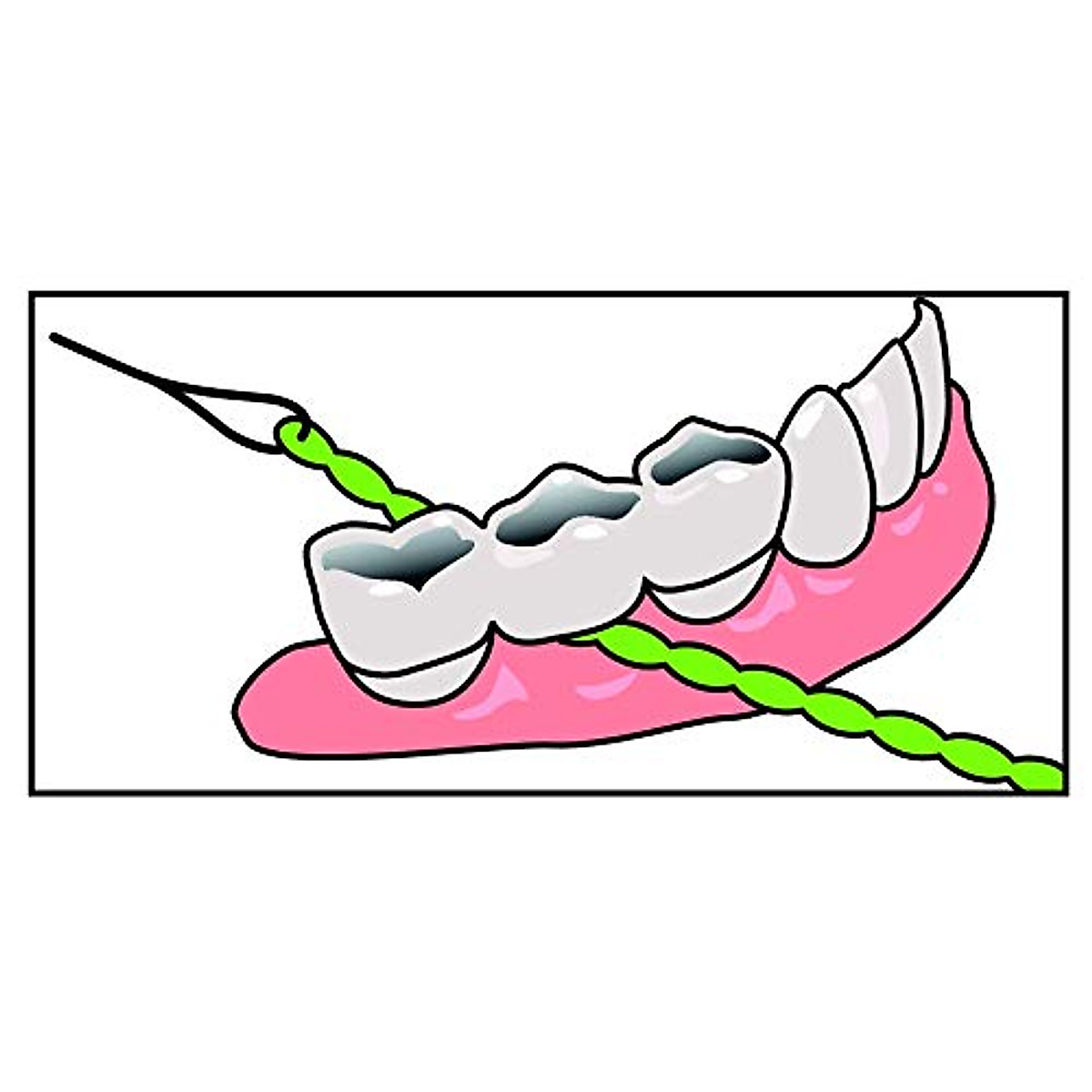 IDontix Brace X-Floss, Green