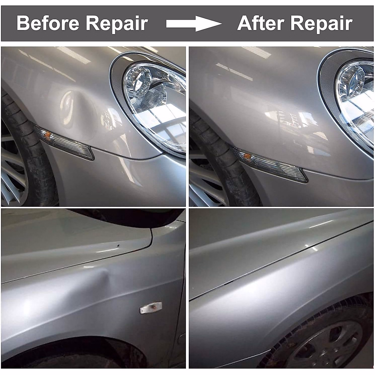 GLISTON Car Dent Remover Tool, Paintless Dent Repair Kit, Pro Slide Hammer Tools with 16pcs Thickened Black Tabs for DIY Automobile Body Dent Removal