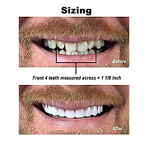 Billy Bob Instant Smile Comfort Fit Flex Cosmetic Teeth, Bright White Shade, Comfortable Upper Veneer, 1 Size Fits Most