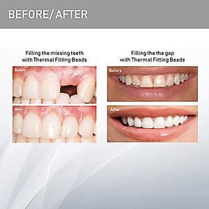 Teeth Repair Kit, Temporary Teeth replacement kit, Moldable False Teeth, Thermal Fitting Beads for Snap On Instant and Confident Smile, with Mouth Mirror, Mouth Tweezer, Dental Probe