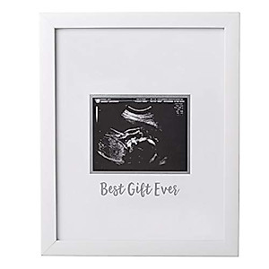 Tiny Ideas Sonogram Signature Frame Guest Book, Perfect for Any Baby Registry, Marker Included for Guests to Leave Well-Wishes, Great for Celebrating Baby Showers or Birthdays, White
