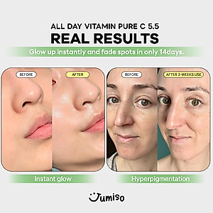 All Day Pure C 5.5 Glow Serum 30ml | Aronia Fruit Extract | Pure Vitamin C (L-Ascorbic Acid) with Alpha-Arbutin&Ascorbyl Glucoside | fragrance-free, parabens-free | 1.01 fl oz, 30 ml