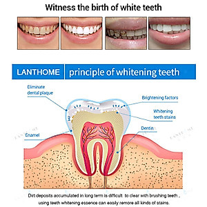 Teeth Whitening Pen, Teeth Whitening Essence Pen, Speed Whitening Gel, No Sensitivity, Travel-Friendly, Easy to Use, Removal Teeth Reduce Yellowing (2pc)