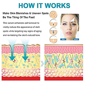 Dark Spot Remover for Face, Fast-Acting Dark Spot Corrector Remover for Face and body Hyperpigmentation, Fades Melasma, Freckle, Sun Spots, Evens Skin Tone, Age Spot Remover for Women Men