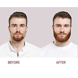 TOMUM Biotin Hair Growth Shampoo for Men and Women - Treatment for Thinning Hair and Hair Loss - Biotin,Caffeine & Saw Palmetto Enriched Formula for Hair Thickening and Regrowth DHT Blocker 13.5 FlOz