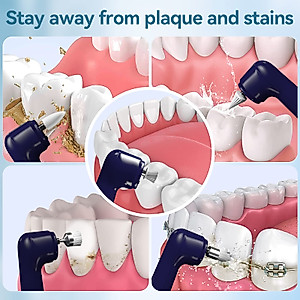 Jeyoe Teeth Polisher Stain Remover,Professional Dental Polisher with 5 Replacement Heads & Cleaning Modes,USB Rechargeable,Ipx6 Waterproof,Teeth Polisher Electric Professional for Adults &Kids Blue.