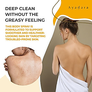 Acne Treatment Body Spray, 8 fl oz, Cystic Back Acne Treatment Spray with Salicylic Acid, Tea Tree Chest, Butt and Body Acne Spray for Hormonal Acne, Bacne Treatment for Teens Adults, 2000 Sprays