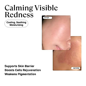 MATKAS Korean Dark Spot Remover for Face & Body Serum + Niacinamide + Oat Extract for Deep Correcting Uneven Skin Tone, Brightening Hyperpigmentation Treatment, Dark Spot Corrector Lightening Cream