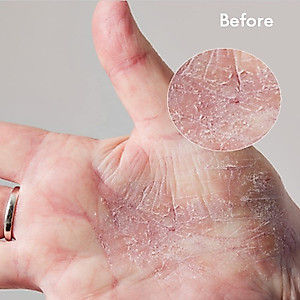 Lanolips 101 Dry Skin Super Cream - Body Cream & Face Moisturizer - Whipped Body Butter for Dry Skin - Triple Lanolin, Sweet Almond Oil, Shea Butter & Vitamin E Infused Body Care (2.02 oz)