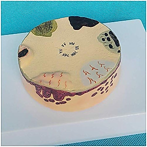 Anatomy Model Human Skin - Skin Enlarged Anatomy Model - Medical Anatomical Skin Structure Model Medical Teaching Model - for Medical Educational Aid