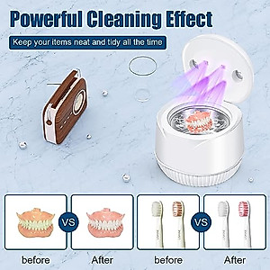 HUPZUND Ultrasonic Retainer Cleaner, 45kHz Ultrasonic UV Cleaner for Dentures, Retainer, Mouth Guard, Aligner, Whitening Trays, Toothbrush Head, 200ml Ultrasonic Cleaner Machine for Jewelry Diamond