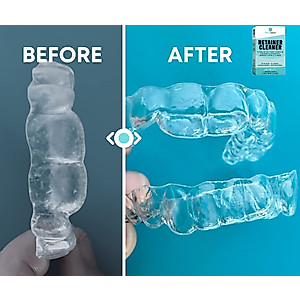 Retainer Cleaner, Denture Cleaner (120 Tablets) Removes Cloudiness, Brightens and Freshens Clear Aligners, Retainers, Night Guards, Mouth Guards, Dental Appliances, Fresh Knight