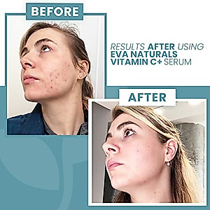 Eva Naturals Vitamin C Serum for Face Plus Hyaluronic Acid, Retinol, Niacinamide & Salicylic Acid, Anti Aging Serum, Reduce Fine Lines, Wrinkles & Dark Spots, Brightening Skin Serum for Glowing Skin (1 oz)