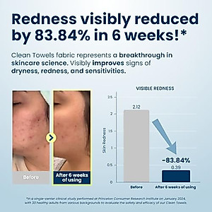 Clean Skin Club Clean Towels, 100% USDA Biobased Dermatologist Approved Face Towel, Disposable Clinically Tested Face Towelette, Facial Washcloth, Makeup Remover Dry Wipes, Ultra Soft, 100 ct, 4 pack