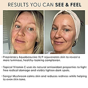 NAVA MD Spot Correcting Serum | Highly Concentrated Solution | Developed by Doctors and Scientists | Target Dark Spots and other Signs of Aging | Contains Aquabeautine XL