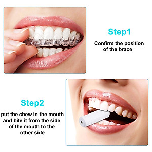 BBTO 60 Pieces Aligner Tray Seaters for Chompers Orthodontic Aligner, 6 Colors