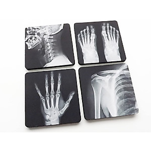 Radiology Drink Coasters Set of 4 or 6 Neoprene or Hardboard Xray Tech Imaging Radiologist Graduation Gift Doctor Nurse