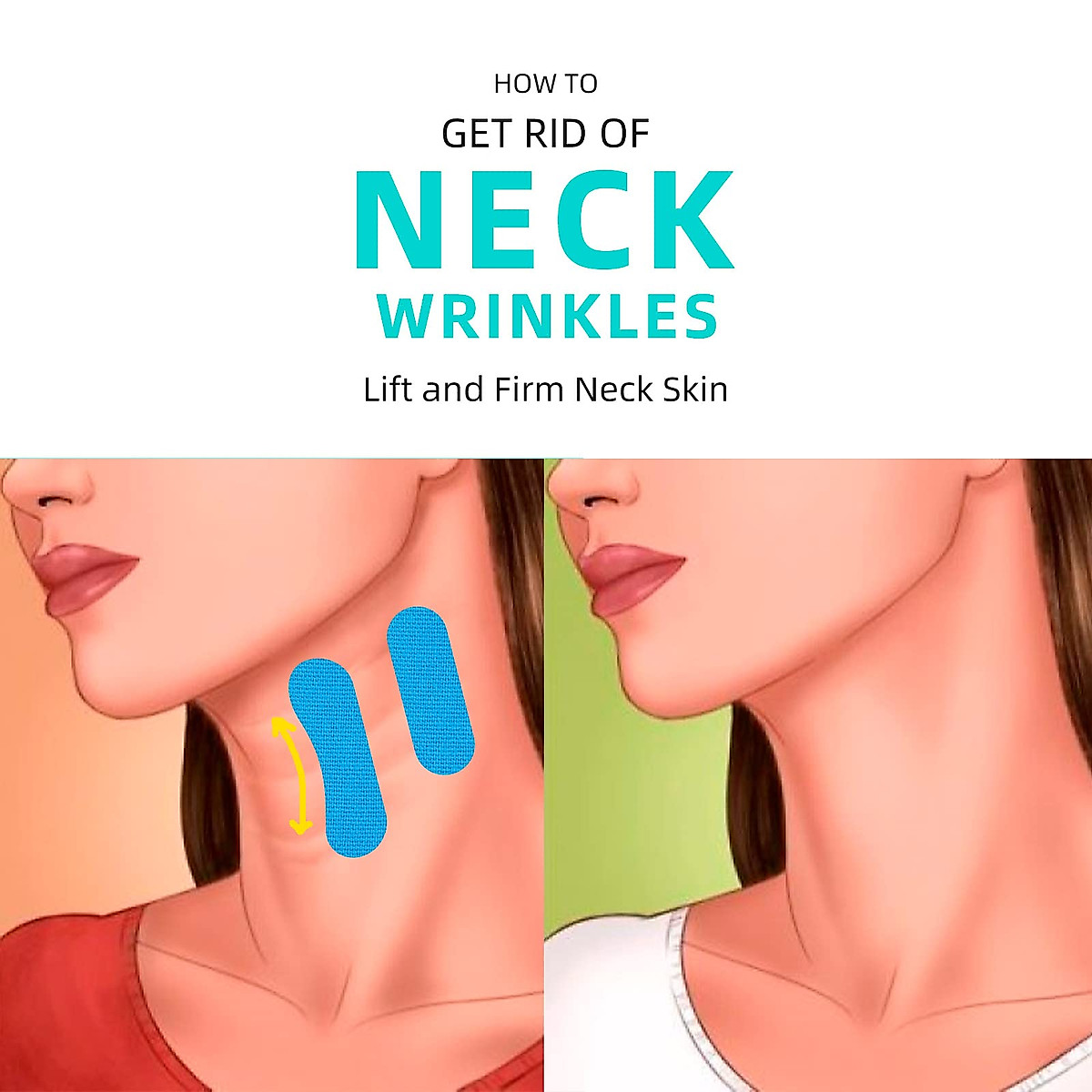 Kindmax Face Tape, 2 Rolls, Anti Wrinkles Patches, Face Eye Neck Lift Tape, V Line Lifting Chin Strap, Face Toning Belts, High Elasticity, Firming and Tightening Skin 2.5cm*5m (Beige)