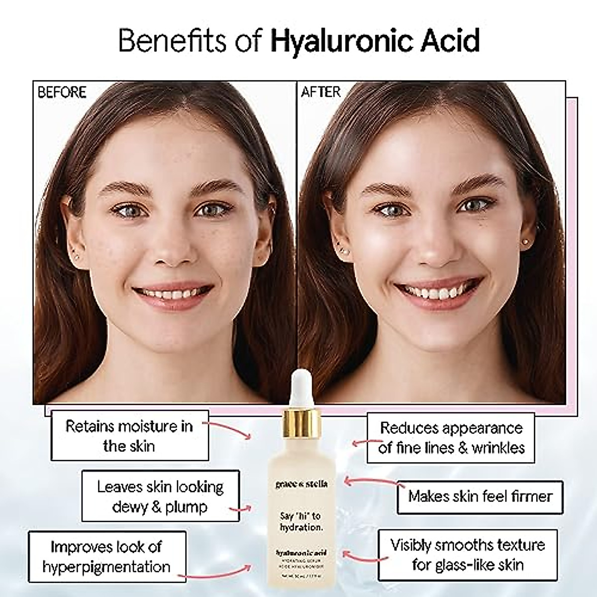 grace & stella Award Winning Hyaluronic Acid Serum (50ml/1.7 fl oz) Hyaluronic Acid Serum for Face - Acido Hialuronico Face Serum for Women - Hydrating Serum Remove Fine Lines, Wrinkles - Anti Aging