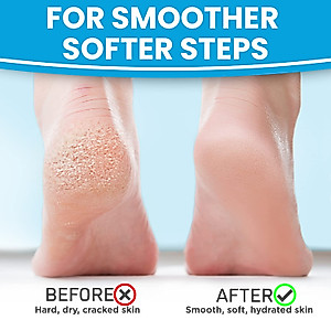 [5PCS Made In Korea] KN FLAX Madforcos Foot moisturizing Mask - Removes Dead Skin for Softer And Smoother Feet - Repairs Rough Heels And Dry Toe Layers - Natural Exfoliation Treatment To Uplift And Rejuvenate Safely