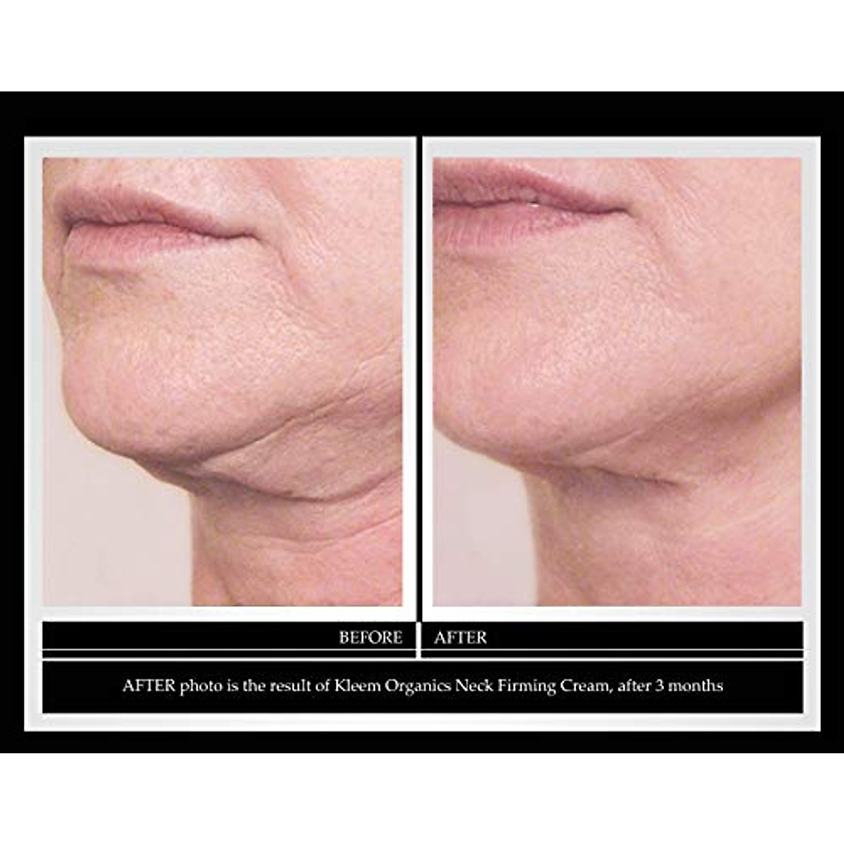 Neck Firming Cream with Peptides & Retinol - Anti Aging Skin Tightening Cream to Reduce Wrinkles, Neck Lines, Age Spots & Sagging Skin - Natural Firming Neck Cream for Smooth & Youthful Skin - 1.7 oz