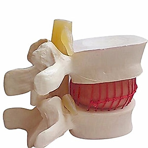 BoNew-Oral 1:1.5 Anatomical Human Lumbar Vertebrae Degenerative Lumbar Human Spine Model White Color