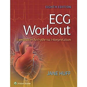 ECG Workout: Exercises in Arrhythmia Interpretation